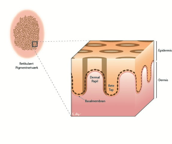 Dermatoskopi - Lægehåndbogen på sundhed.dk
